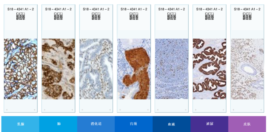 知丘-罗氏诊断推出数字病理AI生态平台，病理诊断的未来是什么？